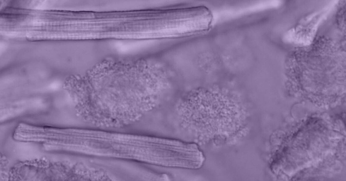 Cell Physiology Workshop Liverpool 2026 | Scientifica