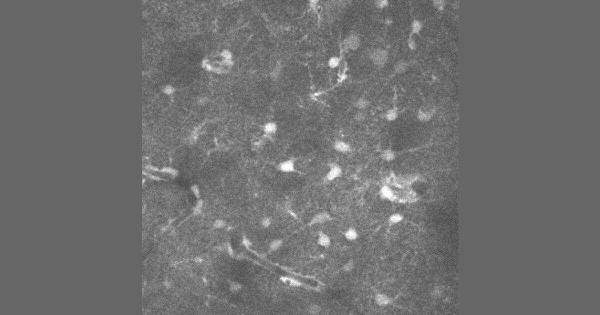 Using a Scientifica Multiphoton Microscope for In Vivo… | Scientifica